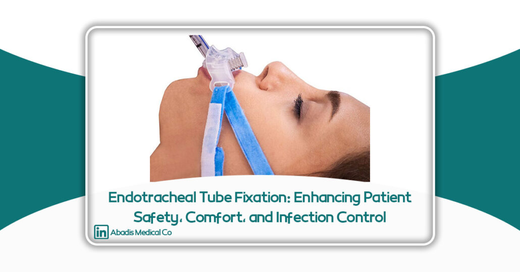 Endotracheal Tube Fixation: Enhancing Patient Safety, Comfort, and ...